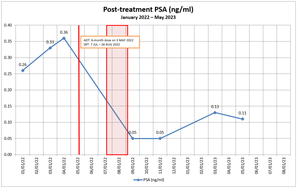 Month 150 – PSA Results – Dan's Journey through Prostate Cancer